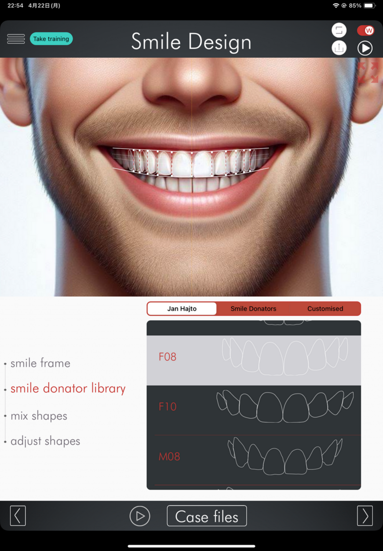 DSD Appが無料に！簡単（？）にスマイルデザインをiPadで - 3D歯科 のデジタル歯医者入門