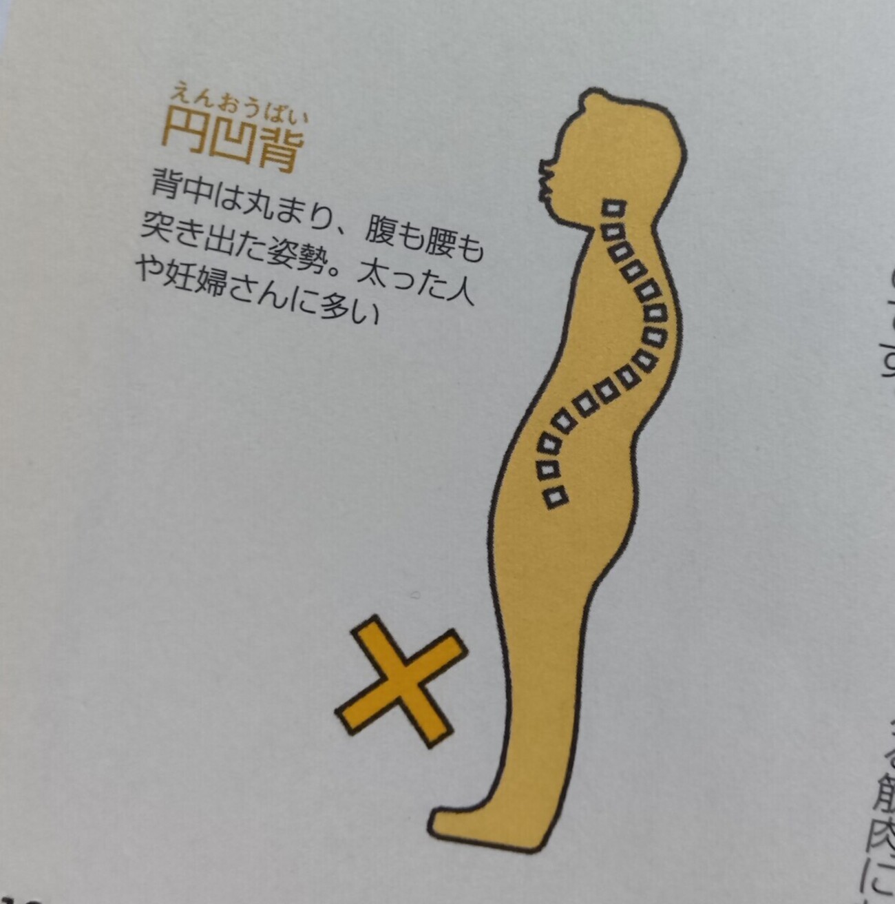 「反り腰」よりも「猫腰」が楽な姿勢？ - honn blog Diary